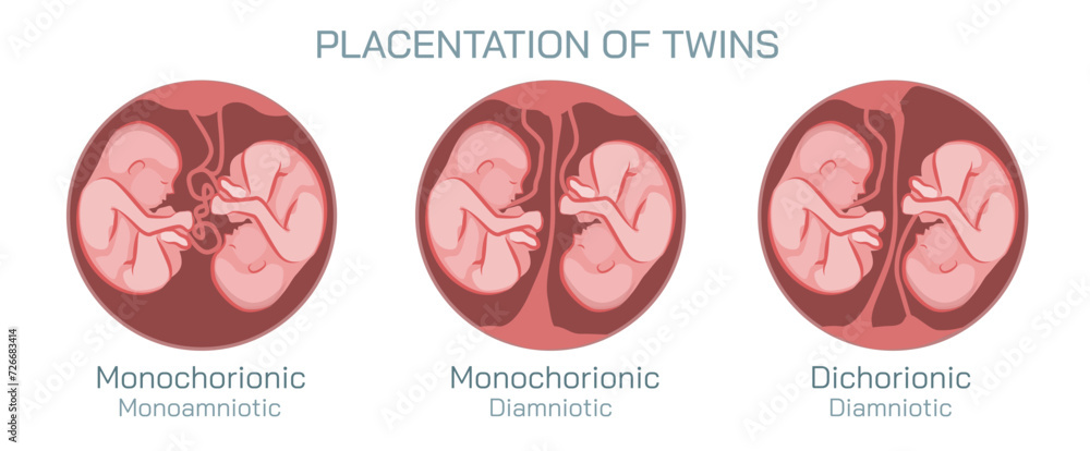 Ovulation, conception and implantation vector illustration. Anatomical ...