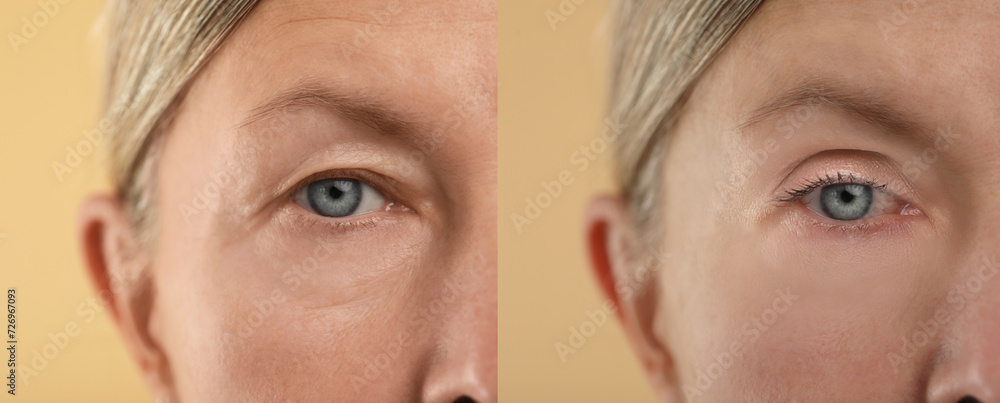 Aging skin changes. Woman showing face before and after rejuvenation ...