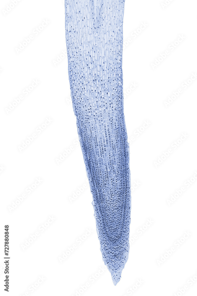 Onion root tip, Allium cepa, showing all stages of mitosis ...