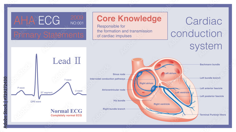 A normal ECG is an ECG that does not have any abnormal changes and can ...
