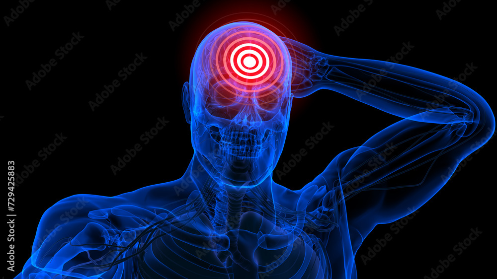 Feeling headache anatomy for medical concept 3D Rendering Stock ...