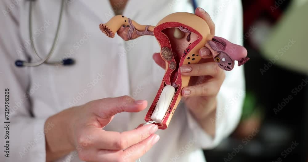 Gynecologist demonstrates model of female reproductive system and ...