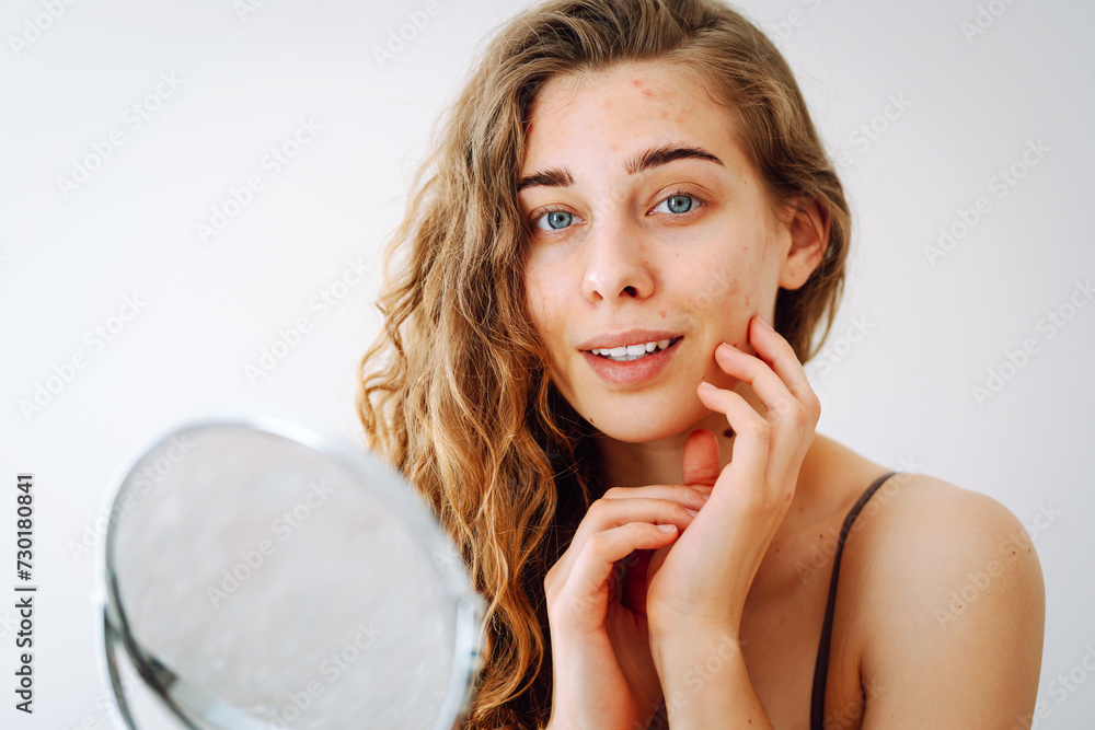 Portrait of a beautiful woman without makeup with imperfect skin. Acne ...