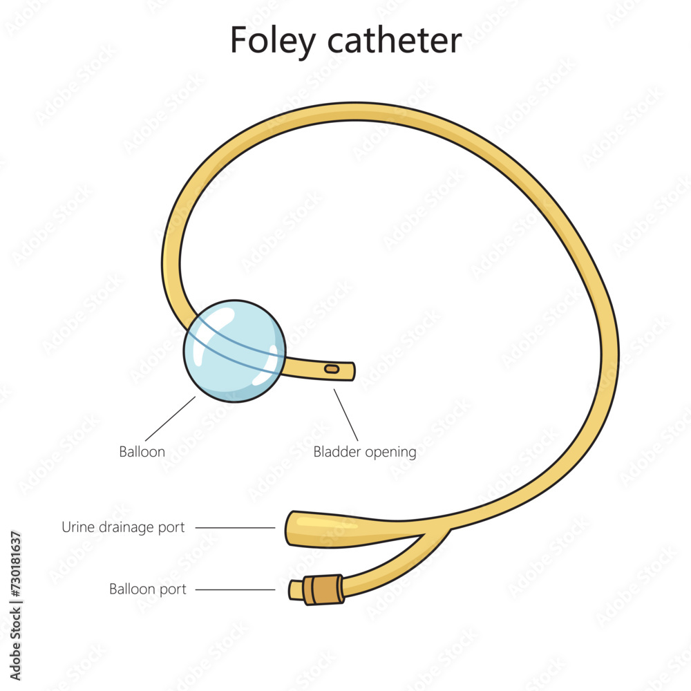 Urinary Foley Catheter Structure Diagram Hand Drawn Schematic Vector Illustration Medical