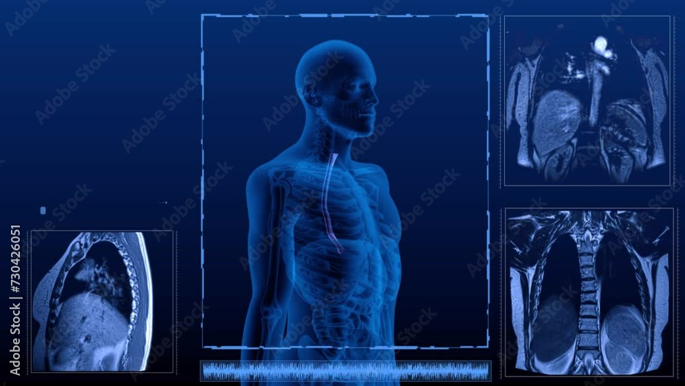 Magnetic resonance tomography scan in different projections of the ...