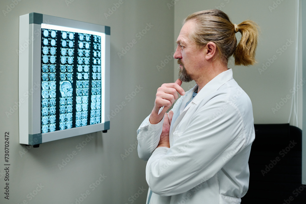 Side view of pensive mature male radiologist looking at ct scan of ...