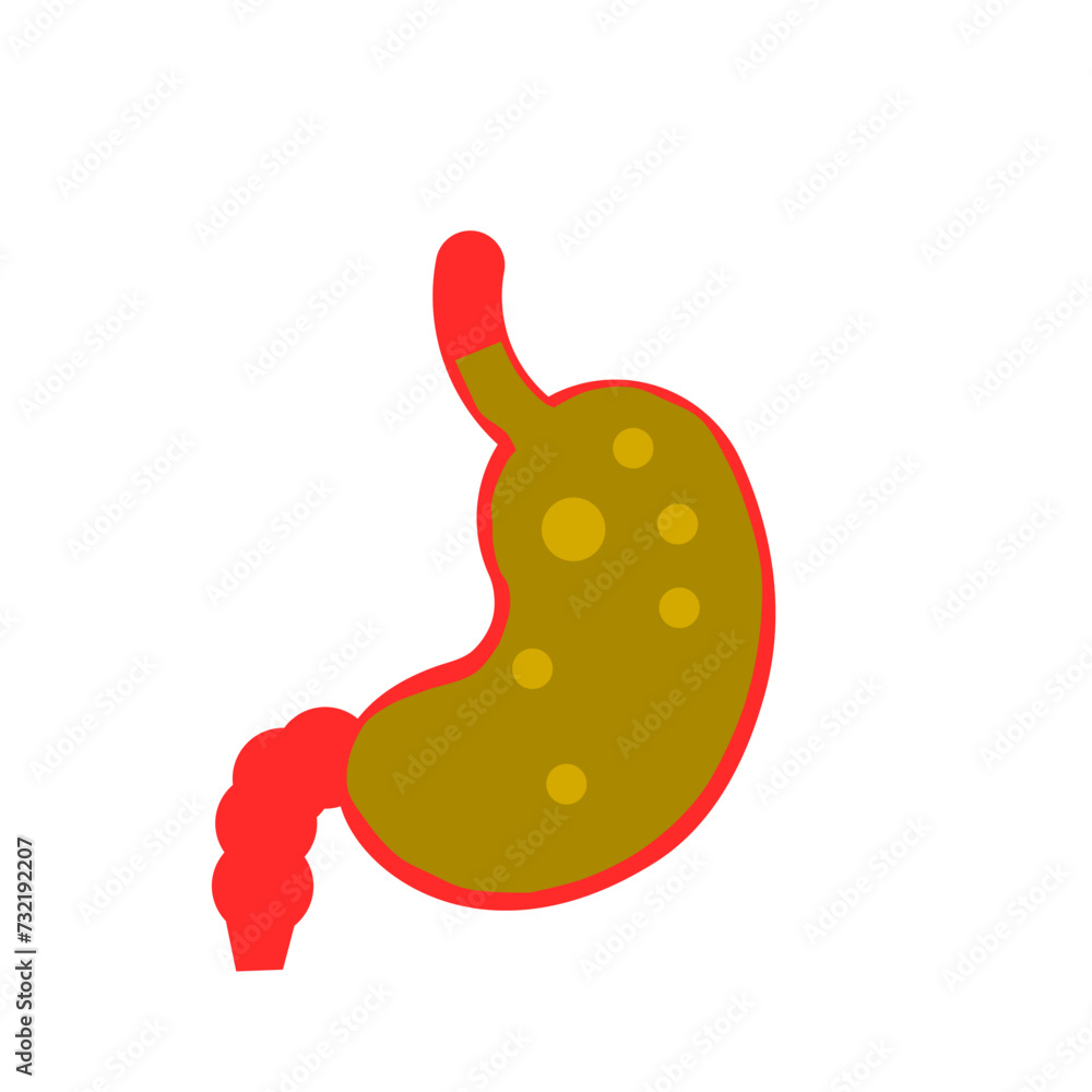 Illustrated Vector Graphics for GERD and Gastric Disease Awareness ...