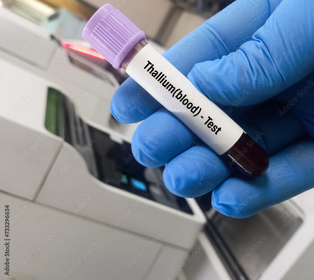 Hand holding blood sample for Thallium blood test, as a biomarker of ...