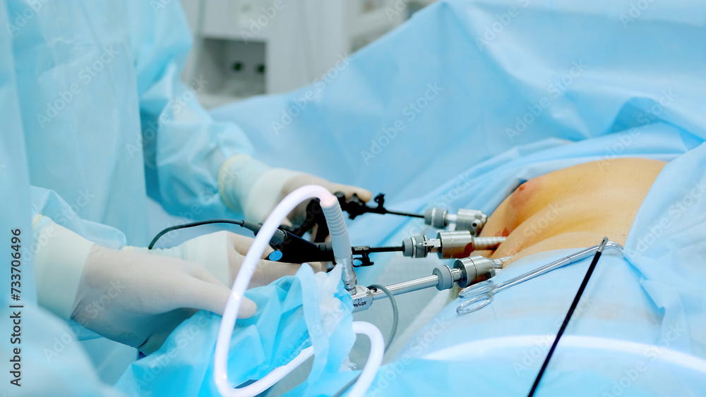 Operating room, team of surgeons performing laparoscopic intervention ...