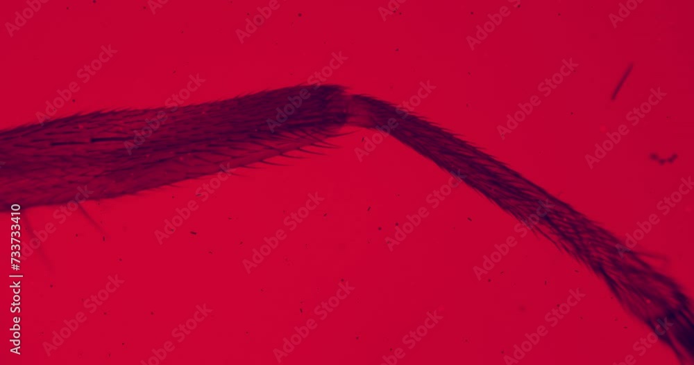 Fly leg under a microscope with floating bacteria, germs and living ...
