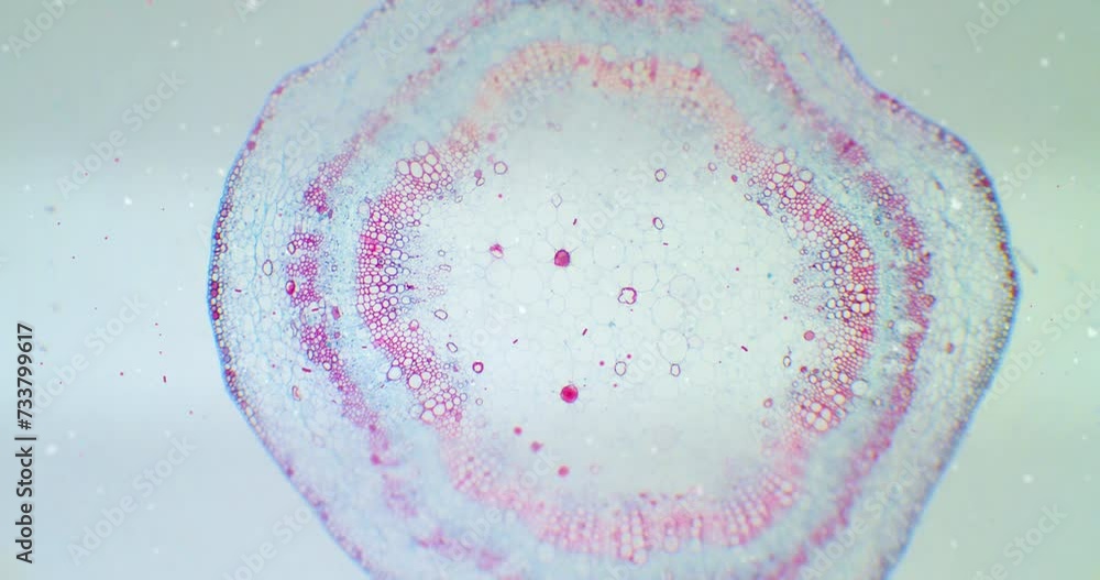 Cotton stem under a microscope with a focus on moving germs, microbes ...