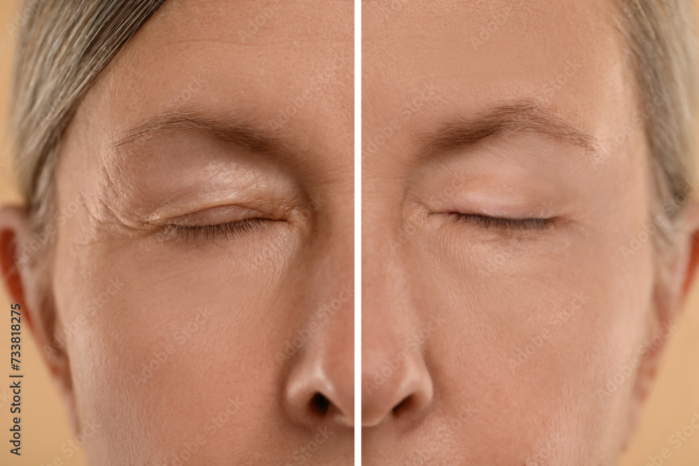 Aging skin changes. Woman showing face before and after rejuvenation ...