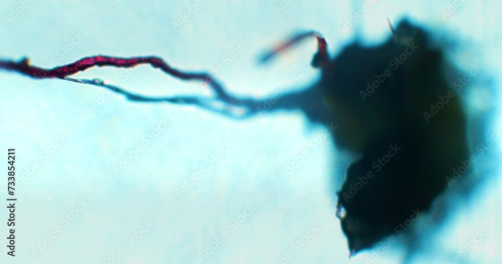 Vidéo Stock Creepy germs and large dark veins under a microscope ...