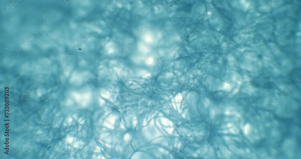 A spider web under a microscope. Floating bacteria and living organisms ...