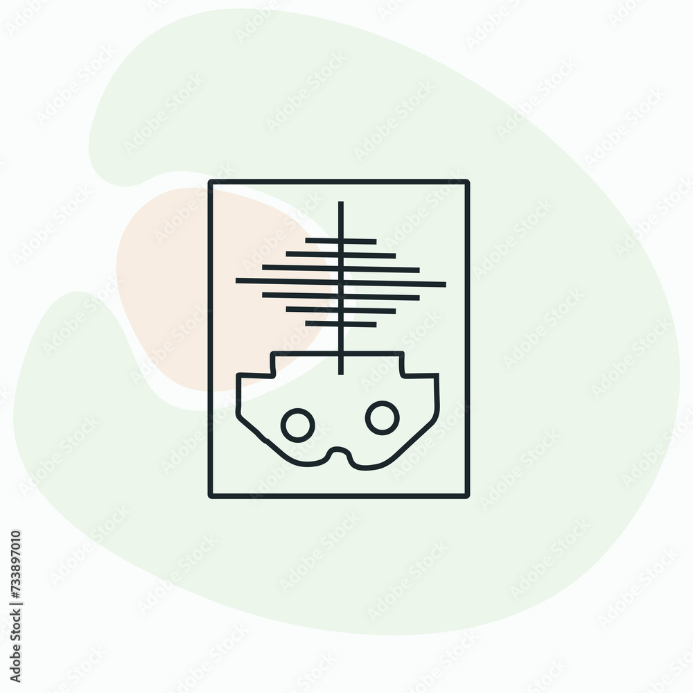 X-rays can provide detailed images of the bones in the spine and may ...