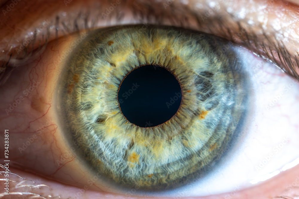 High Resolution Female Green-Blue Colored Eye with Yellow Pigment Spots ...