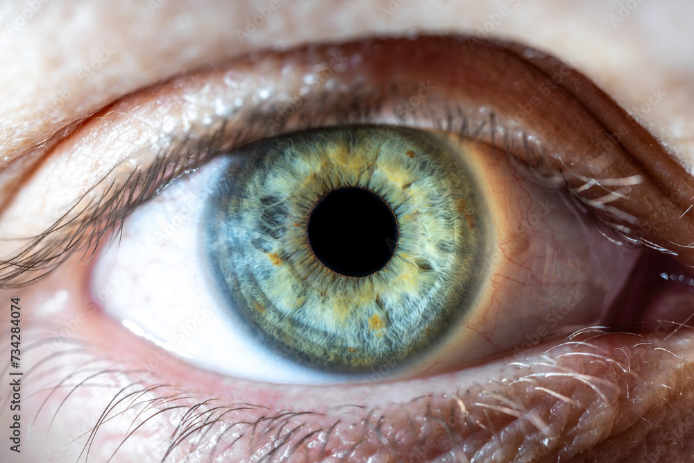 Female Blue-Green Colored Eye with brown pigment spots. Pupil Opened ...