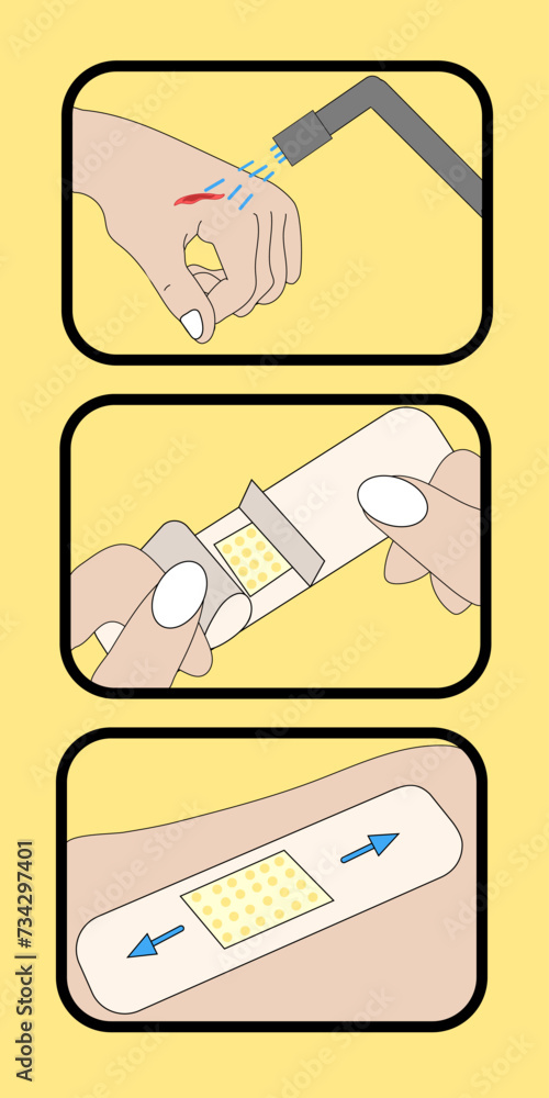 The illustration demonstrates the process of applying a medical plaster ... The illustration demonstrates the process of applying a medical plaster ...