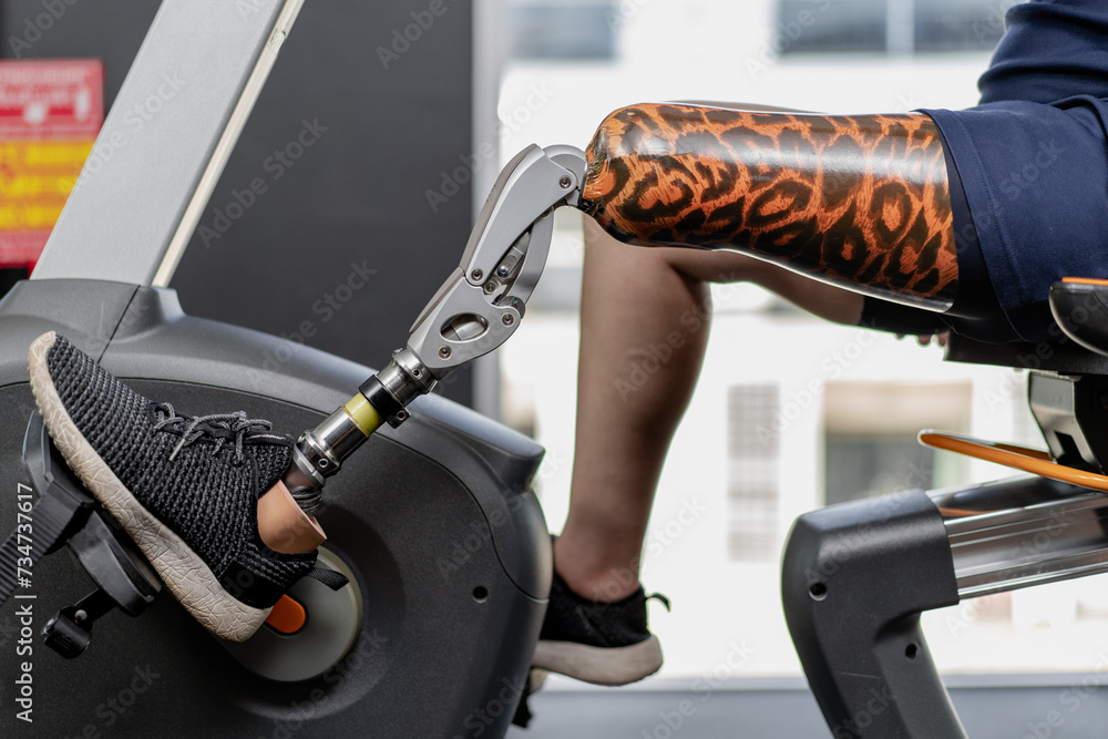 Confident woman with artificial leg exercising in fitness gym ...