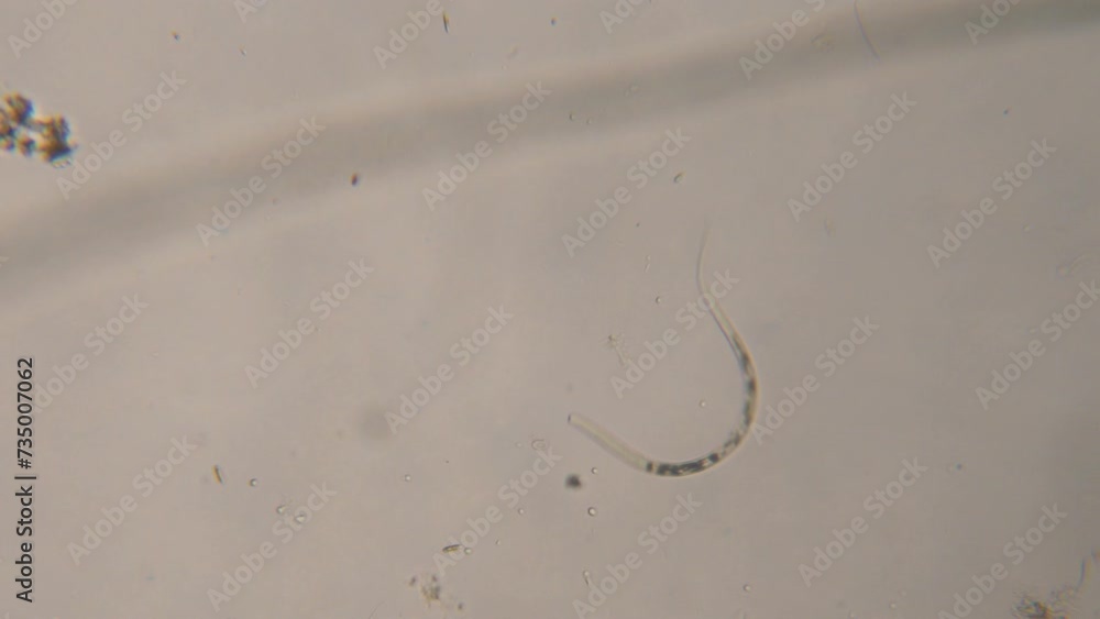 Bacteria Parasites and Worms in drinking Water under Microscope ...