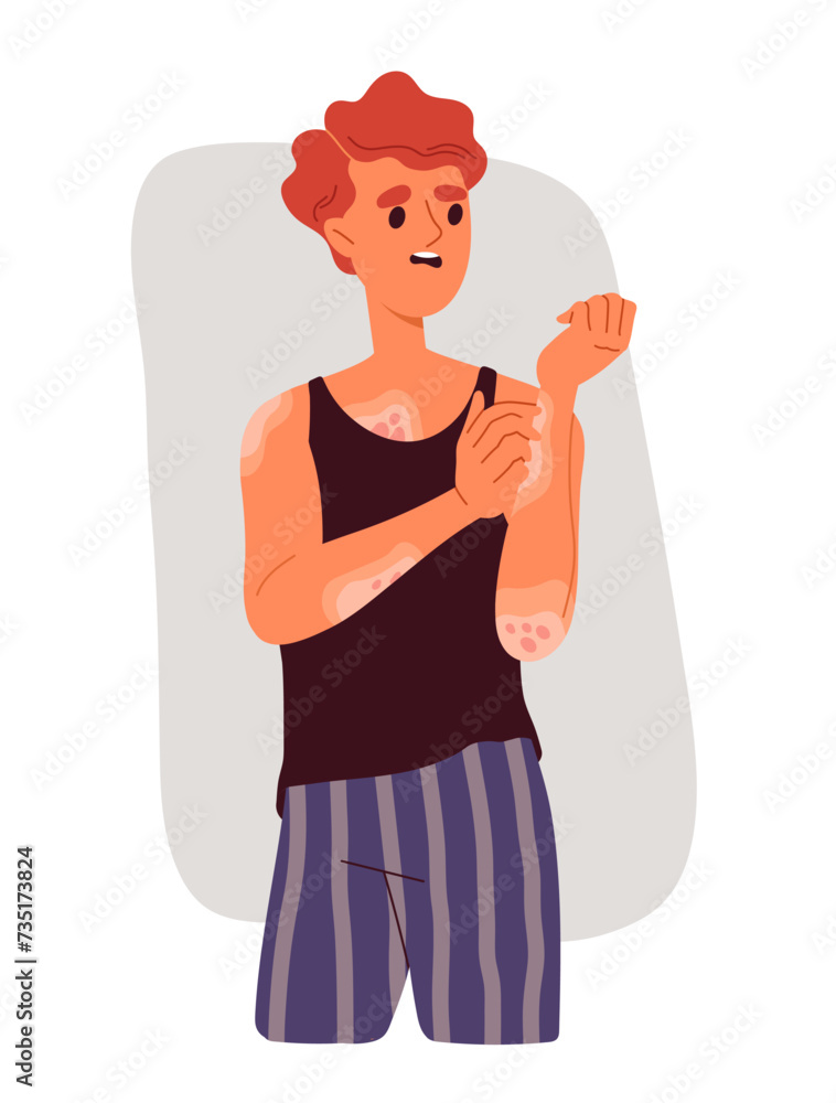 Person with skin disease. Guy with white spots at skin. Dermatological ...