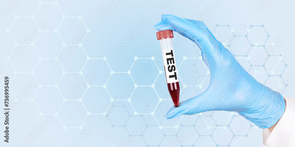Close-up of a female doctor's hand in medical gloves holding a test ...