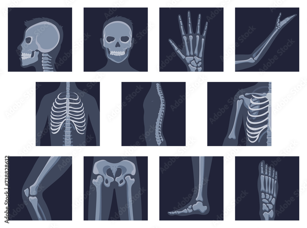 Human bones orthopedic and skeleton icon set, bone x-ray image of human ...