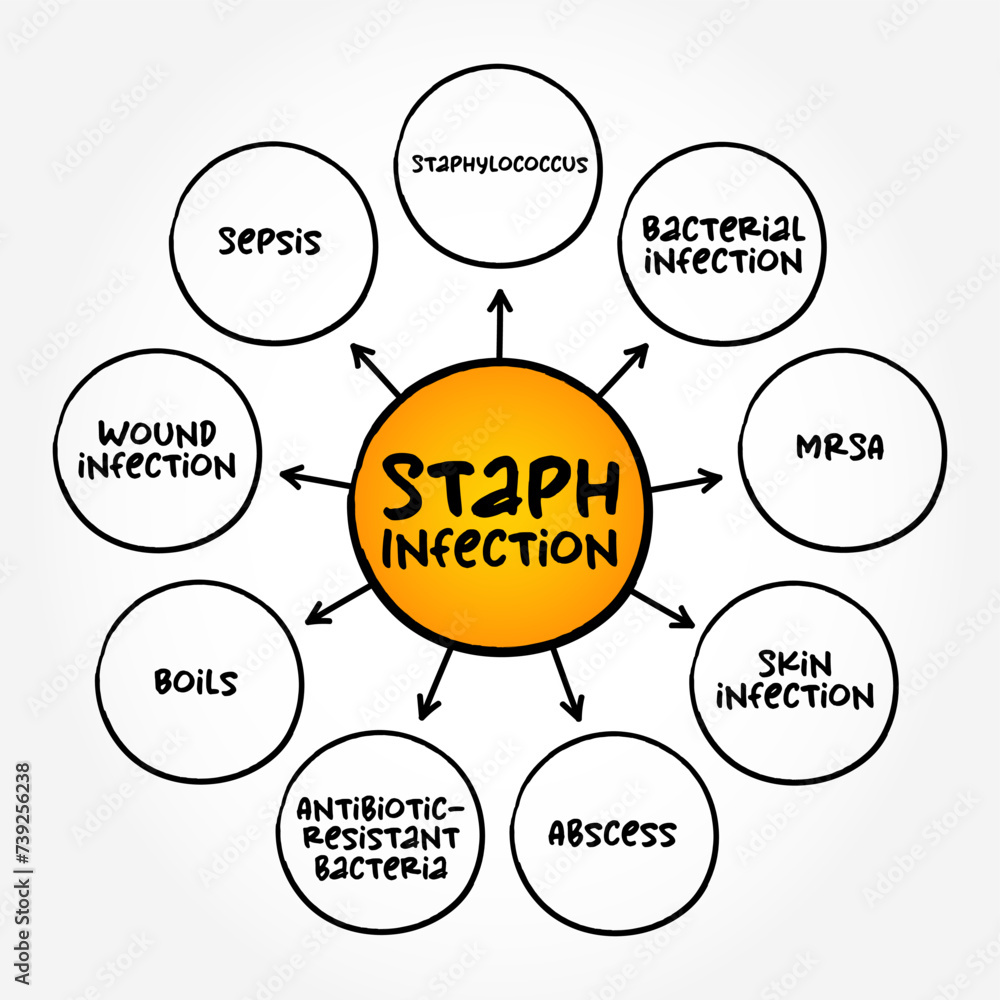 Staph Infection - are caused by staphylococcus bacteria, mind map ...