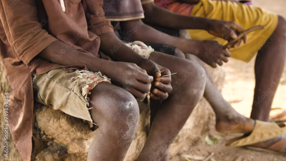 9 jan. 2024,Gwalada,Nigeria: Malnourished child due to extreme poverty ...