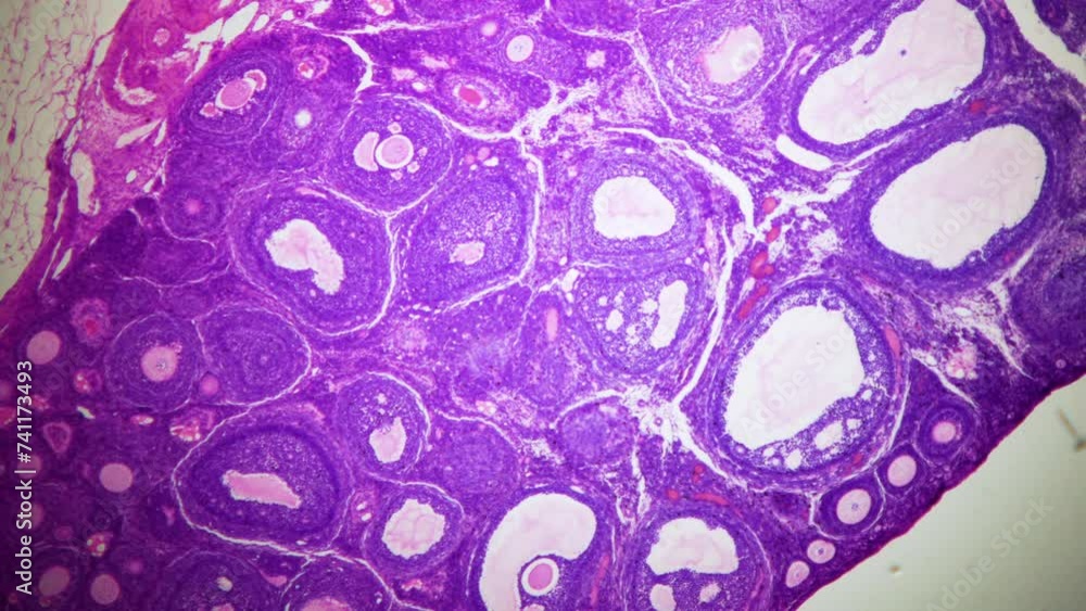 Ovary. Microanatomy. Puberty. Release of hair hormones. Fertility. 100x ...