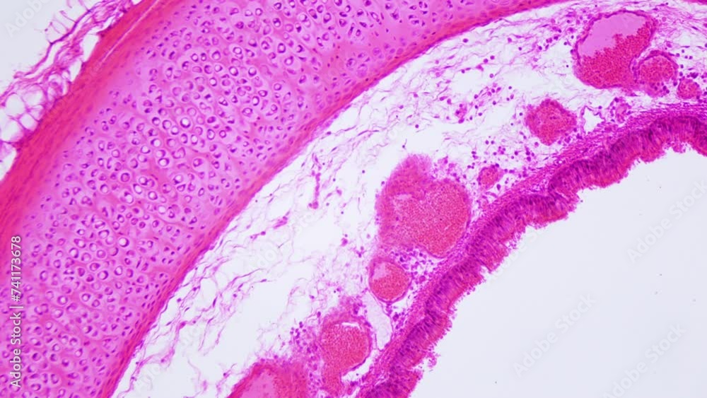 Trachea, view under a microscope. The airways of man. 100X times ...