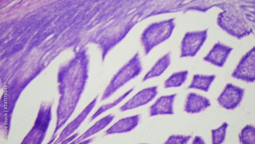 Large intestine (Colon). Cystologic and histologic analysis under the ...