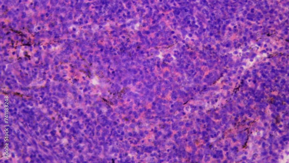 Vidéo Stock Spleen under microscope. 400x magnification. Organ of ...