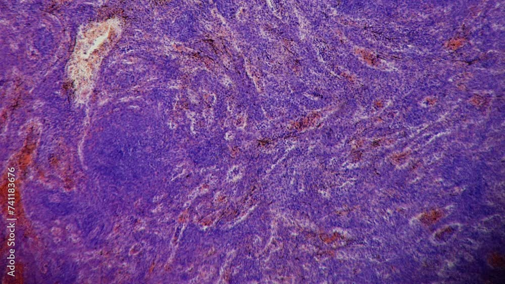 Vidéo Stock Spleen. 100x magnification. Largest lymphoid organ in ... Vidéo Stock Spleen. 100x magnification. Largest lymphoid organ in ...