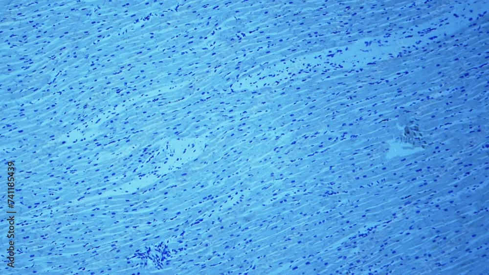 Histologic study of human heart muscle under a microscope. 100x ...