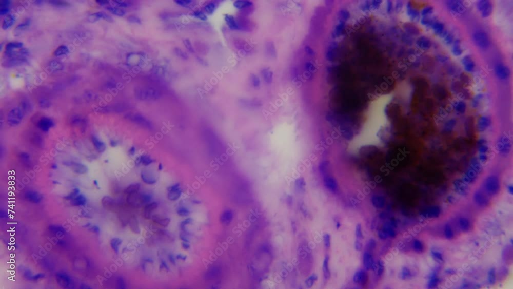 Pancreas. Microanatomy. Pancreatic biopsy section. 1000x times ...