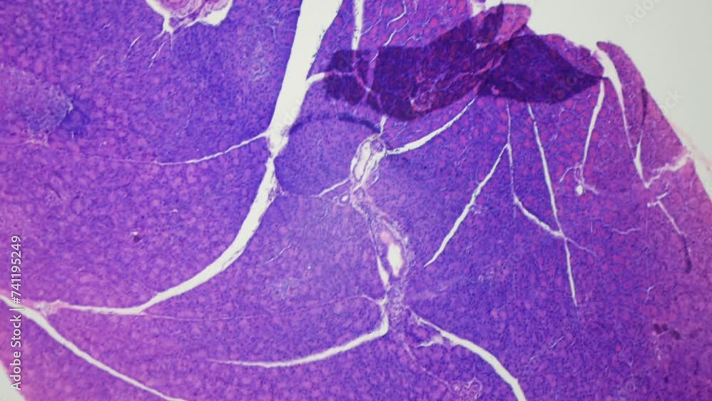 Pancreas. Microanatomy. Pancreatic biopsy section. 100x magnification ...