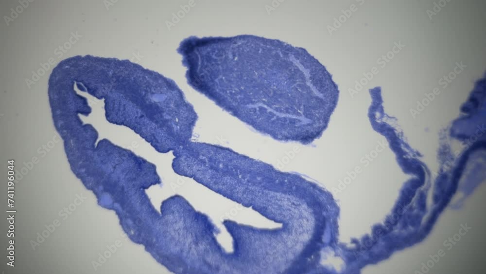 Vidéo Stock Mammalian uterus. Microanatomy. Uterine biopsy section ...