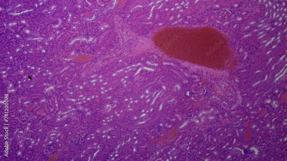 Kidney under the microscope, longitudinal section. Histologic and ...