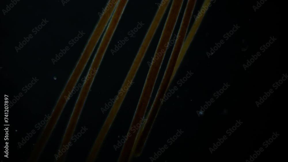 Brittle, emaciated hair. Trichology lab. Human hair under the ...