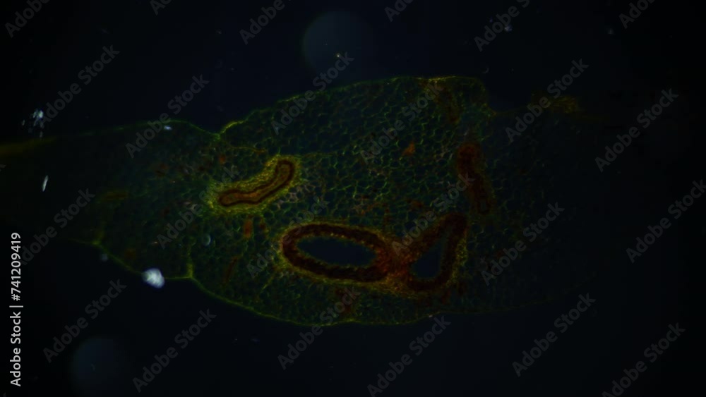 Angiology Laboratory Examination of a cross section of blood vessels ...