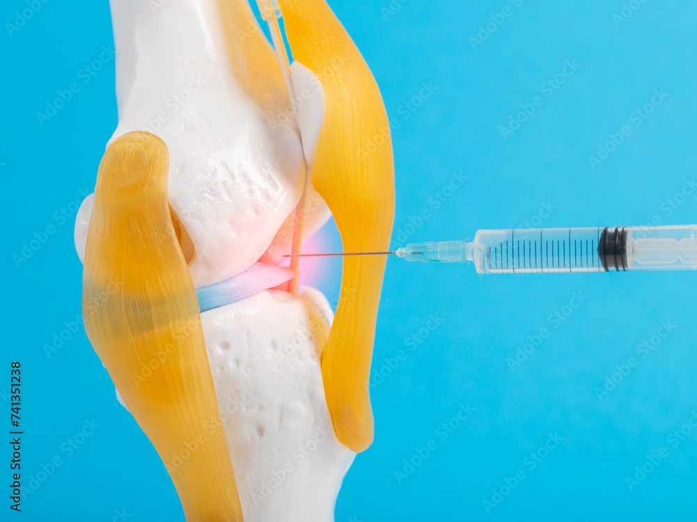 Drug blockade in a mock-up of the knee joint on a blue background. The ...