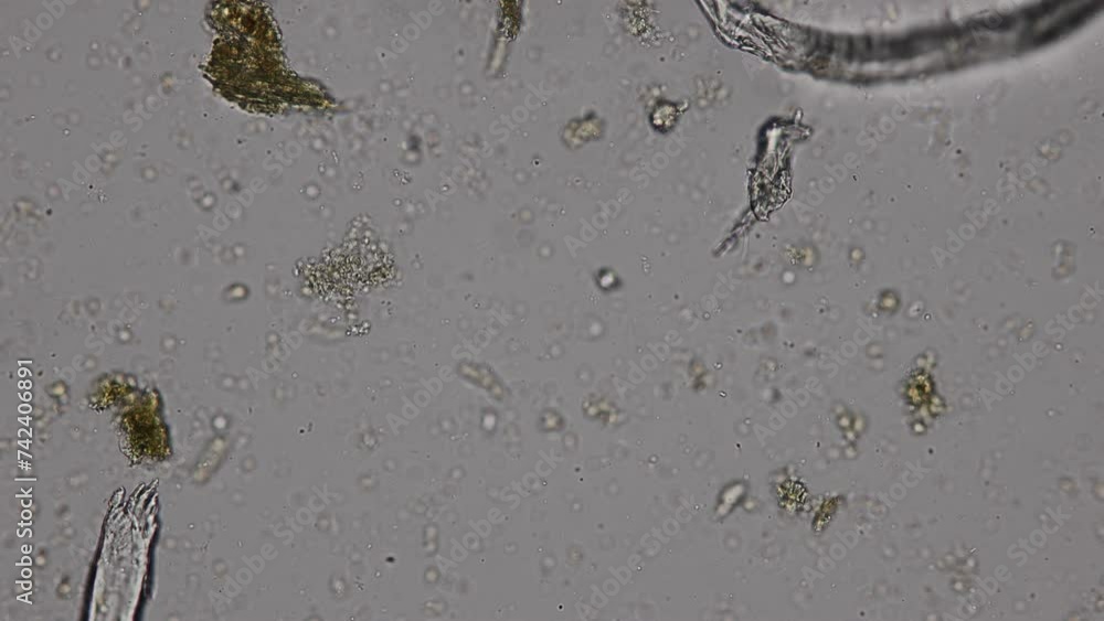 Vidéo Stock Finding Trichuris trichiura egg and Strongyloides egg in ...