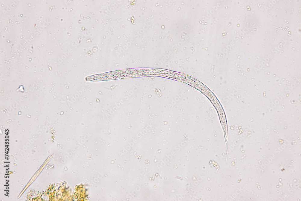 Finding Trichuris trichiura egg and Strongyloides egg in the feces ...