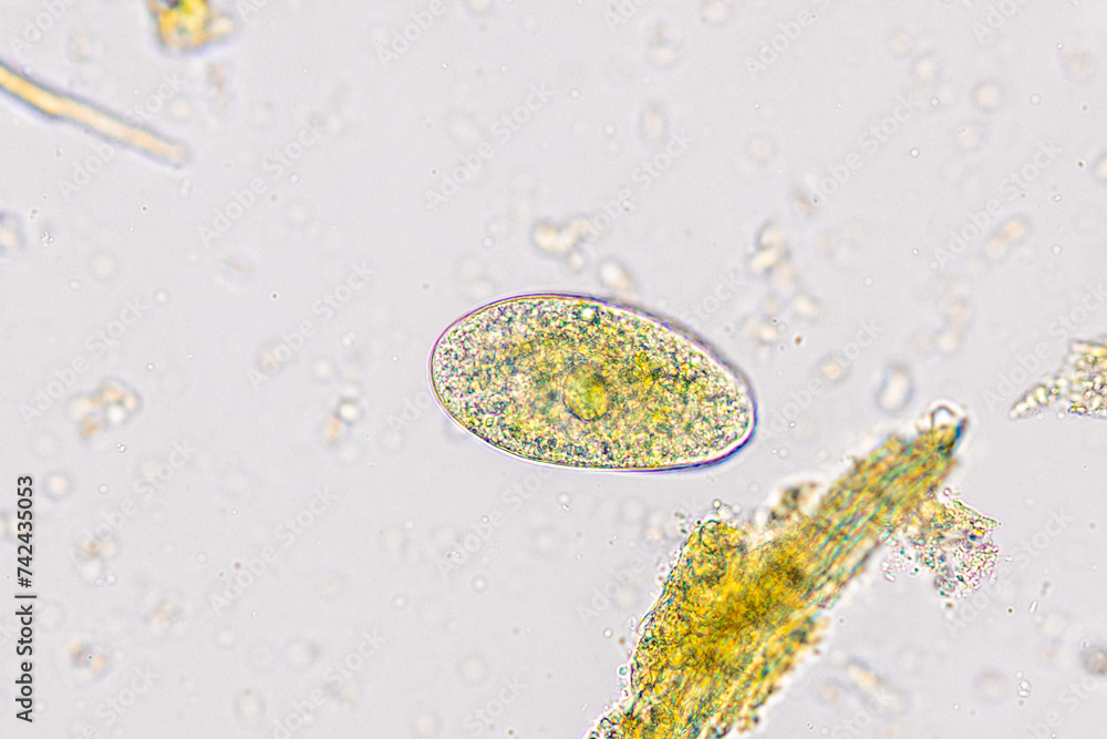 Finding Trichuris trichiura egg and Strongyloides egg in the feces ...
