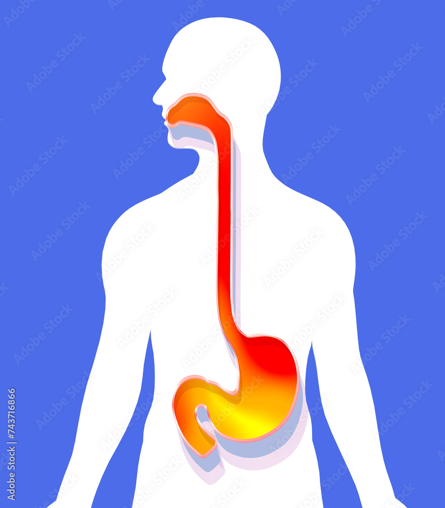 3d illustration of stomach and esophagus to the mouth with fire and ...