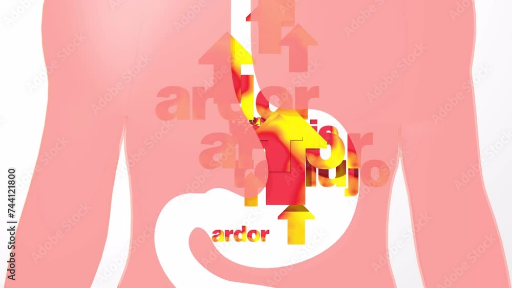 3d animation of digestive system with gastric reflux and heartburn ...