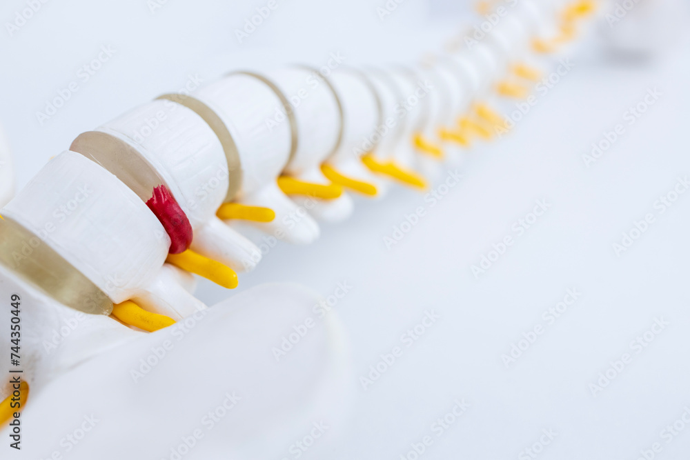 Isolated anatomy spine model on white space background.Orthopedic ...