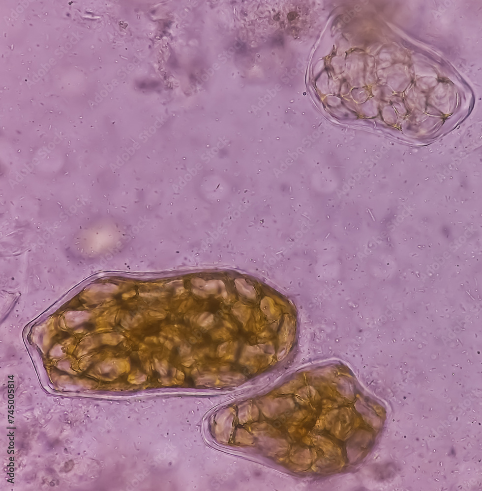 Giardia lamblia cysts and Trophozoite form, muscle fiber in stool ...