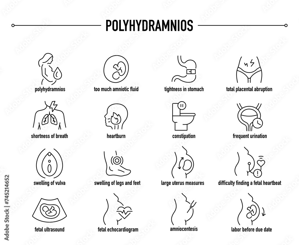 Polyhydramnios symptoms, diagnostic and treatment vector icons. Line ...